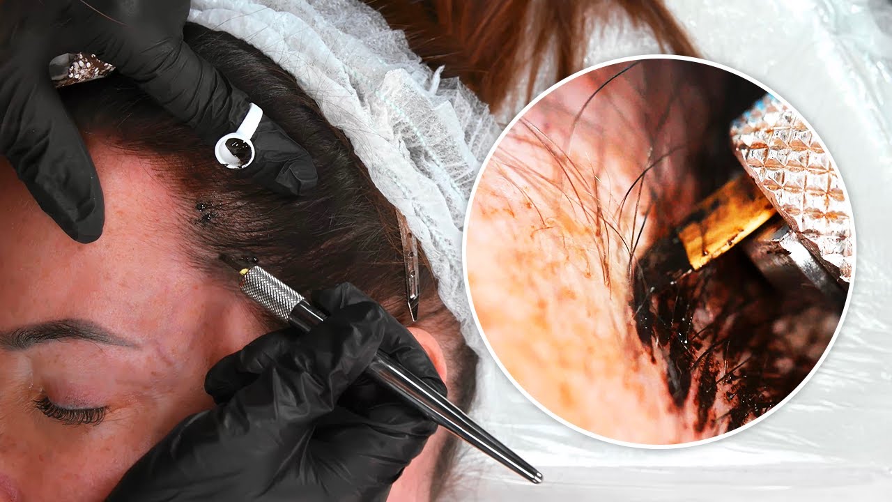 Hair Loss Solution - Natura Clinic